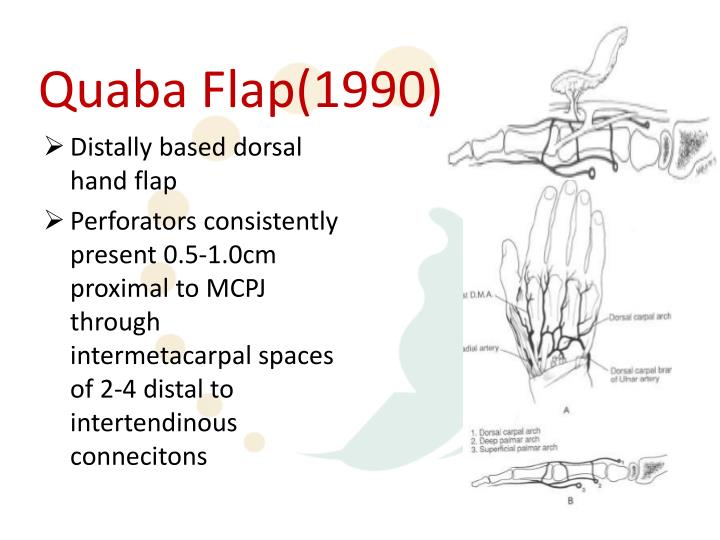 PPT - Flaps in the Hand PowerPoint Presentation - ID:3271054