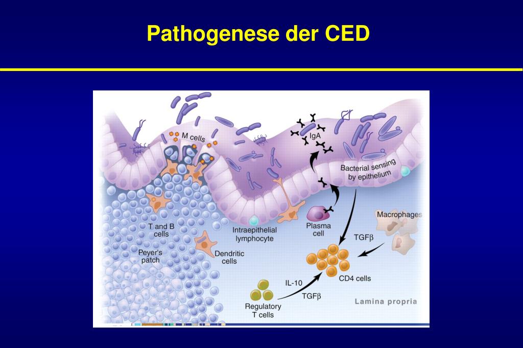 PPT - Chronisch entzündliche Darmerkrankungen (CED) und Herzbeteiligung ...