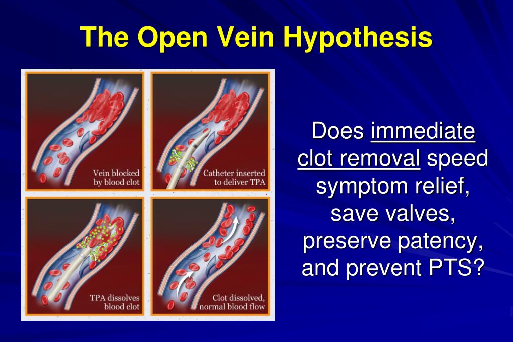 PPT - Suresh Vedantham, M.D. Professor of Radiology & Surgery ...