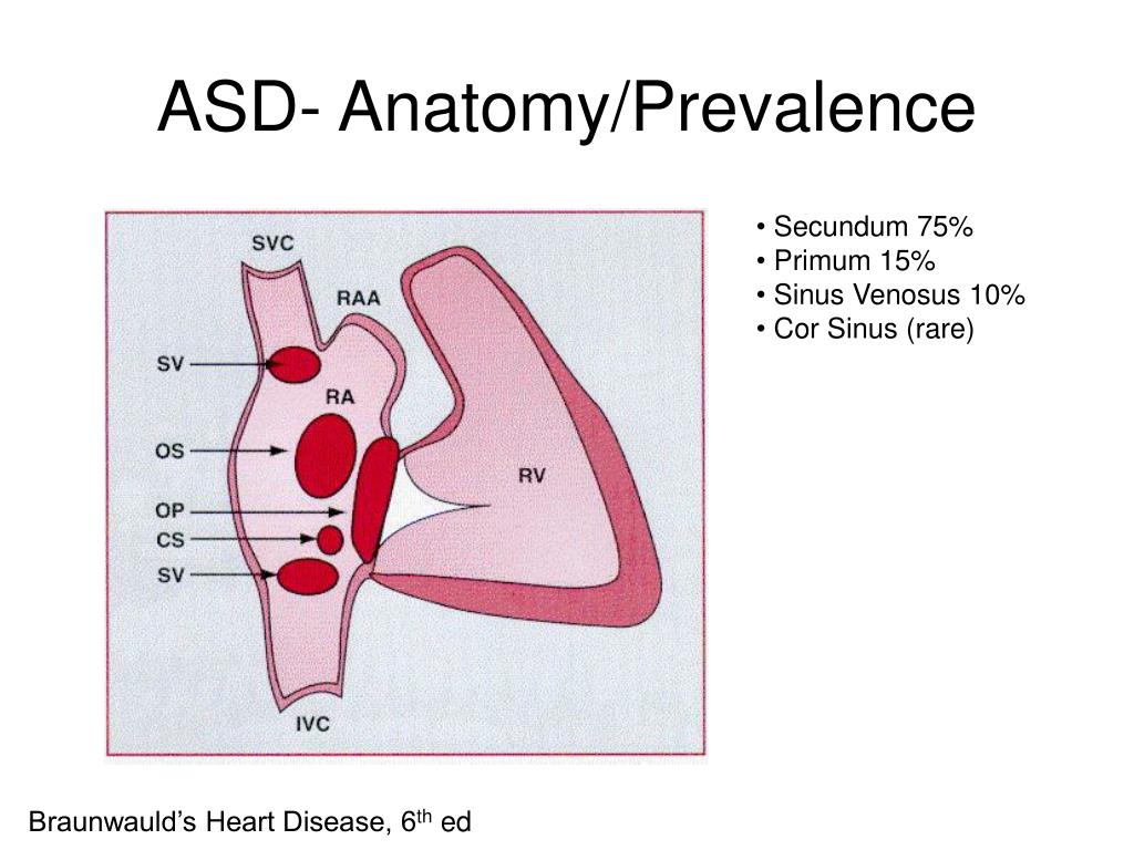 PPT - Adult Congenital Heart Disease PowerPoint Presentation, free ...