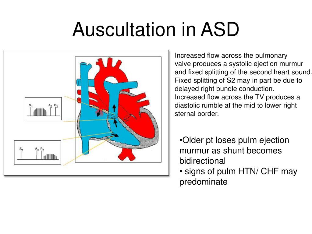 PPT - Adult Congenital Heart Disease PowerPoint Presentation, free ...