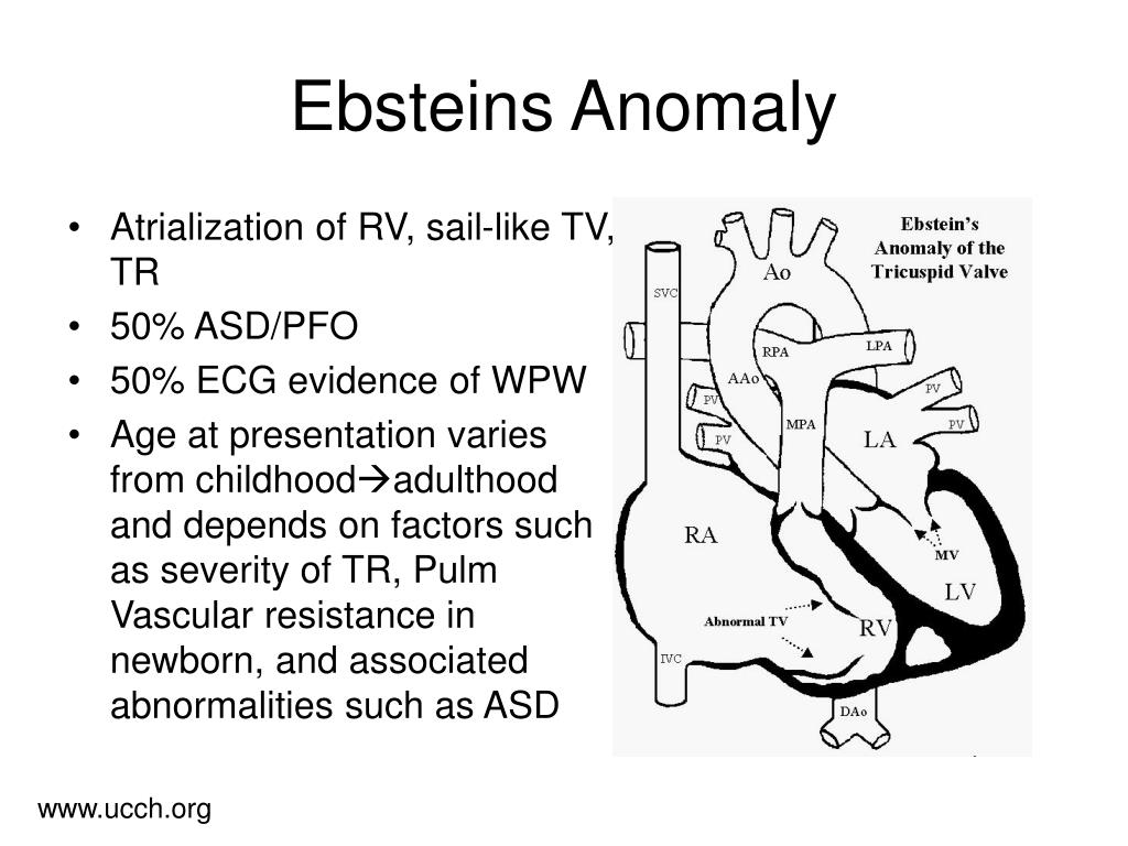 PPT - Adult Congenital Heart Disease PowerPoint Presentation, free ...
