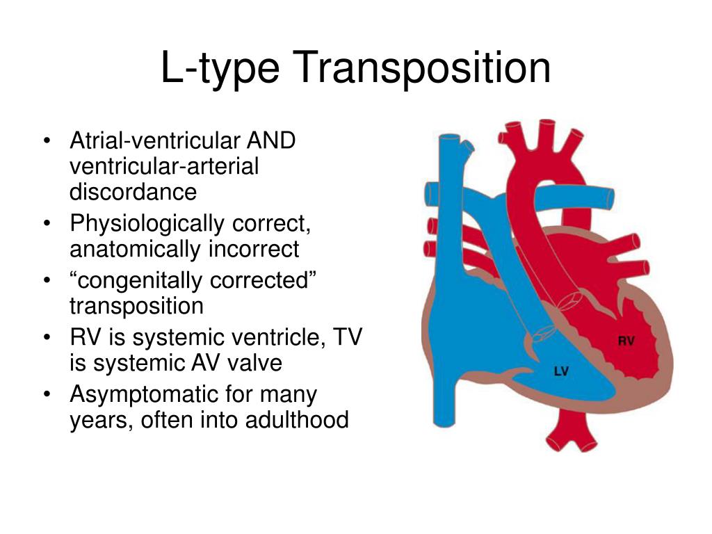 PPT - Adult Congenital Heart Disease PowerPoint Presentation, free ...