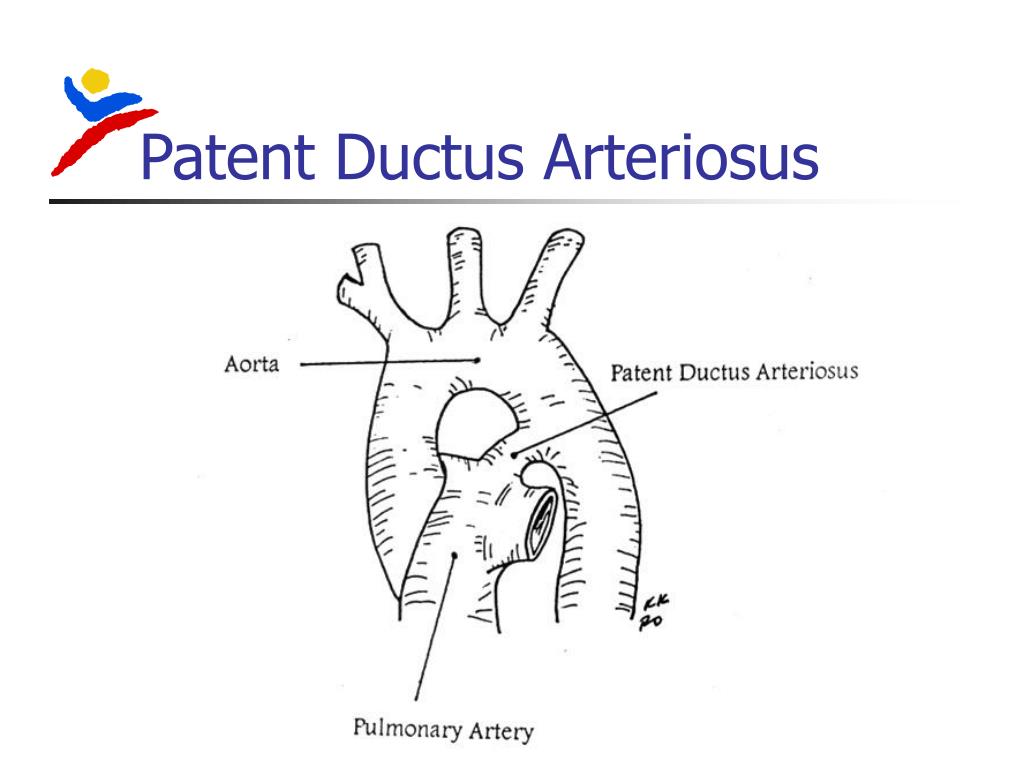 PPT - A Quick Tour of Congenital Heart Disease PowerPoint Presentation ...