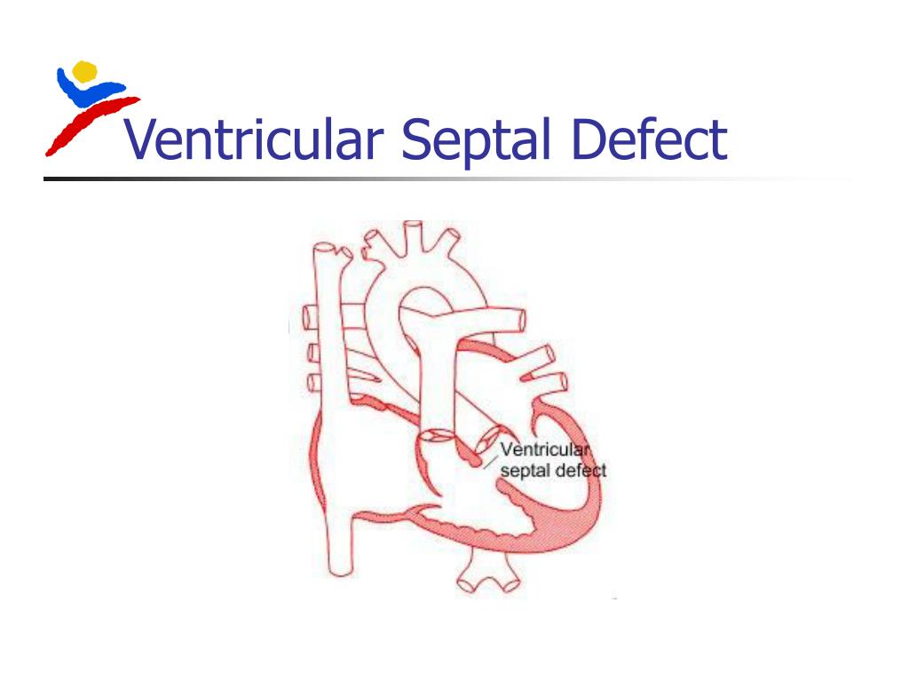 PPT - A Quick Tour of Congenital Heart Disease PowerPoint Presentation ...