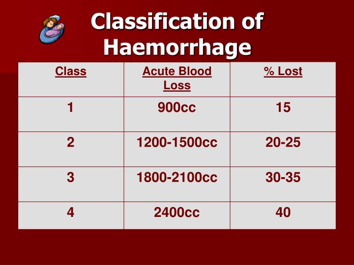 PPT - Maternal Collapse in labour ward PowerPoint Presentation - ID:3278433