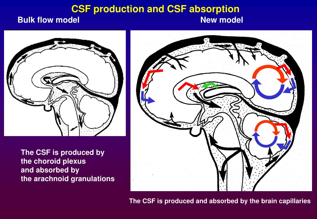 PPT - Dan Greitz Dept. of Neuroradiology Karolinska University Hospital ...