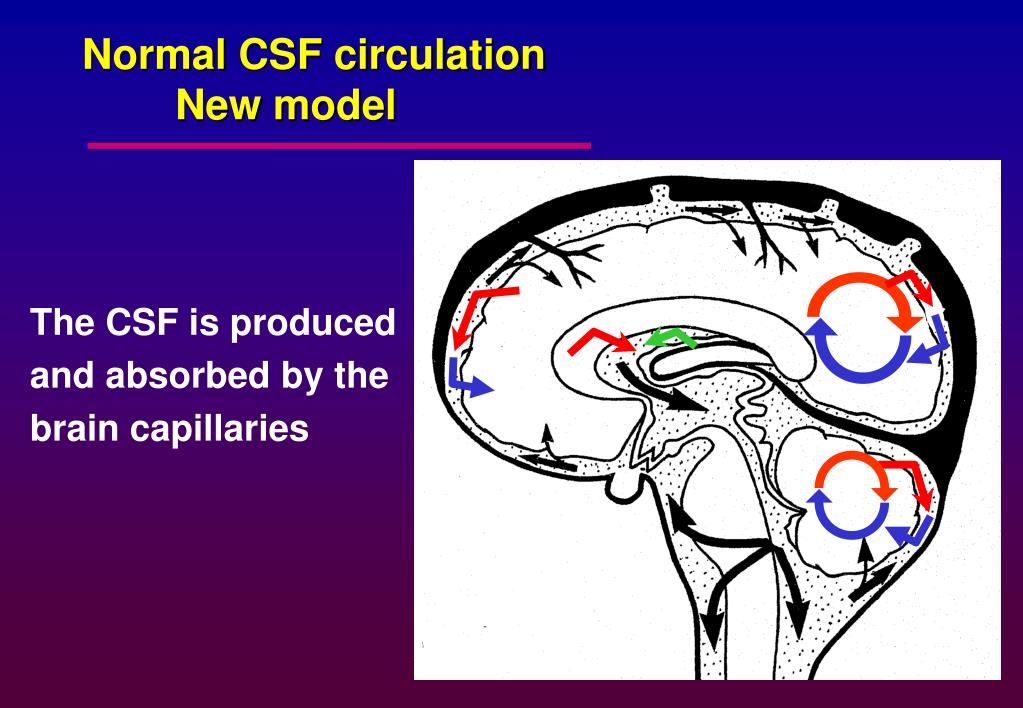 PPT - Dan Greitz Dept. of Neuroradiology Karolinska University Hospital ...