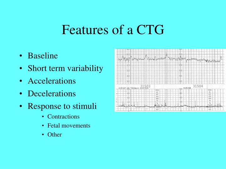 PPT - Understanding Cardiotocography – “CTGs” PowerPoint Presentation ...