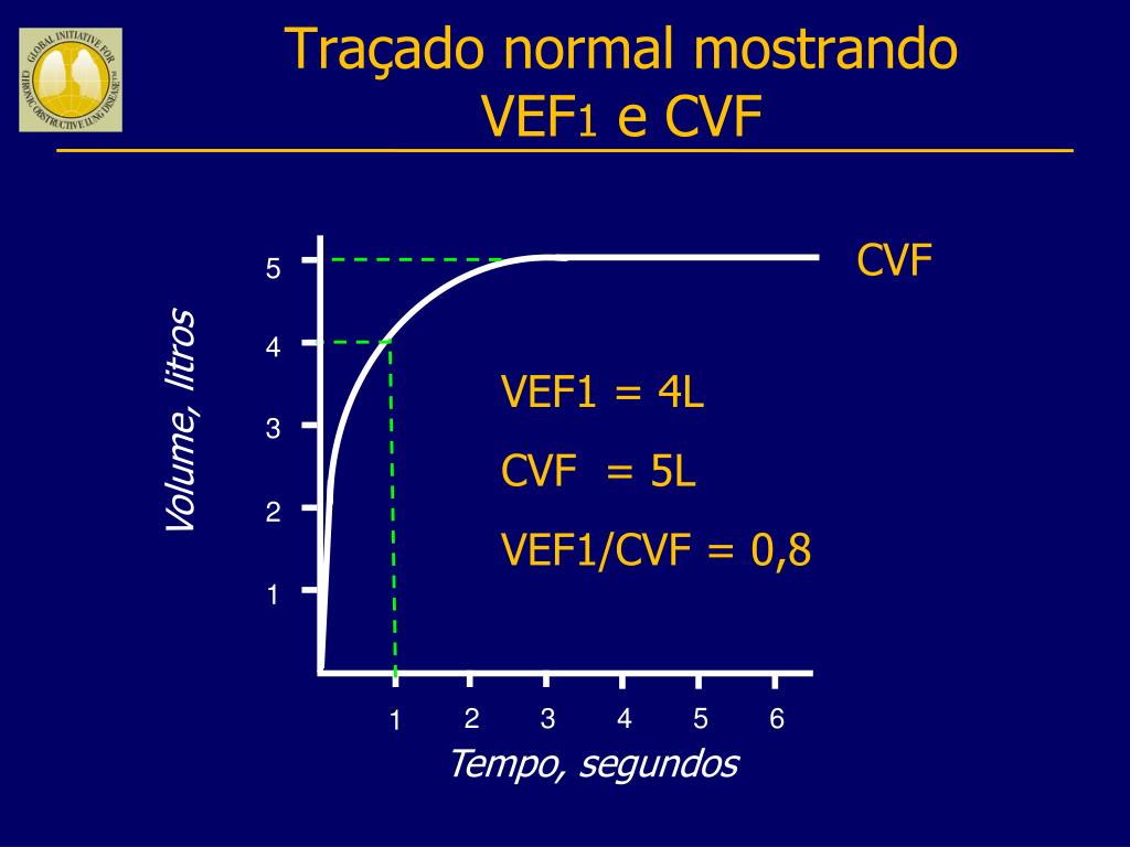 PPT - Espirometria na Clinica Médica PowerPoint Presentation, free ...