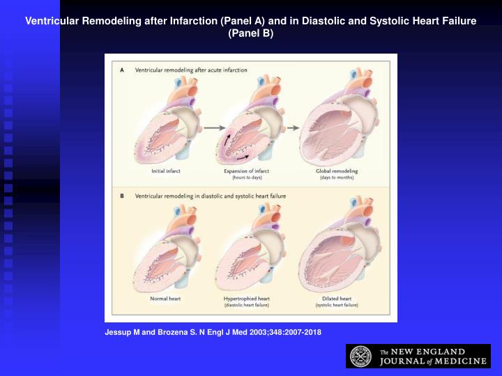 PPT - Congestive Heart Failure PowerPoint Presentation - ID:3281935