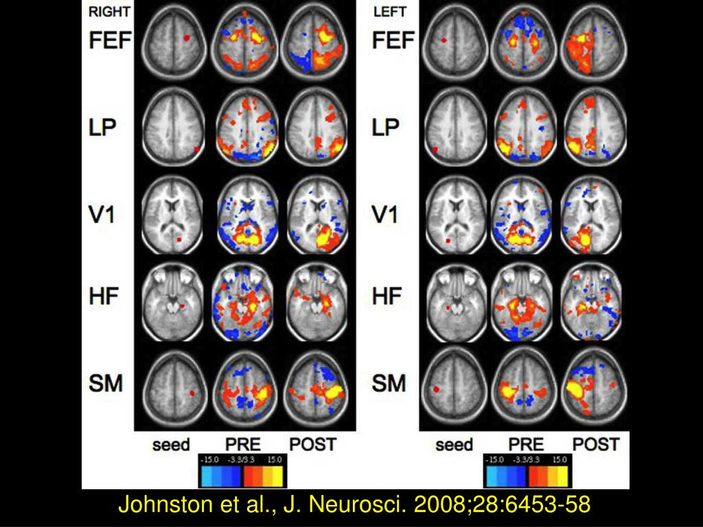 PPT - Resting state fMRI (RS-fMRI; fcMRI) Physiological underpinnings ...