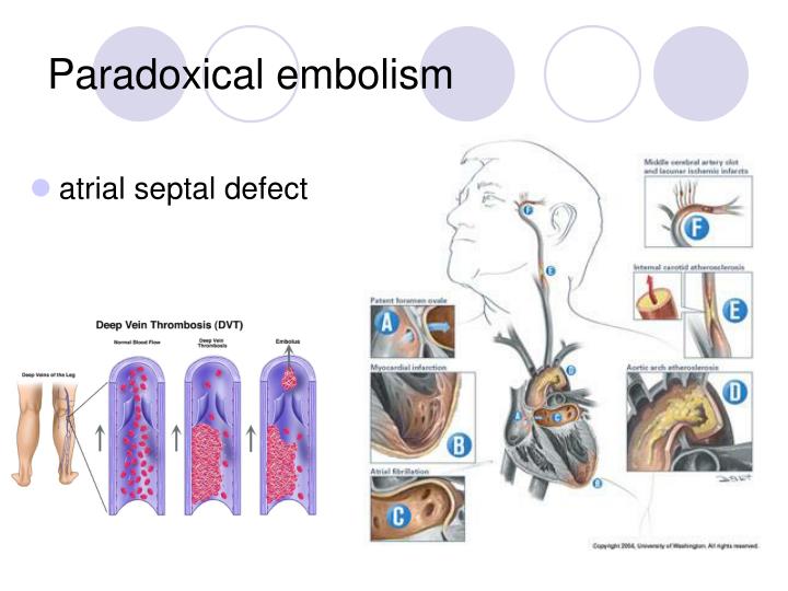 PPT - CEREBROVASCULAR ACCIDENT (CVA) PowerPoint Presentation - ID:3282810