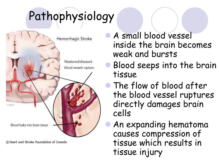 PPT - CEREBROVASCULAR ACCIDENT (CVA) PowerPoint Presentation - ID:3282810