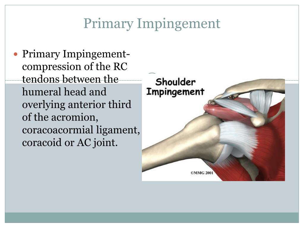 PPT - Rehabilitating Impairments of the Painful Shoulder PowerPoint ...
