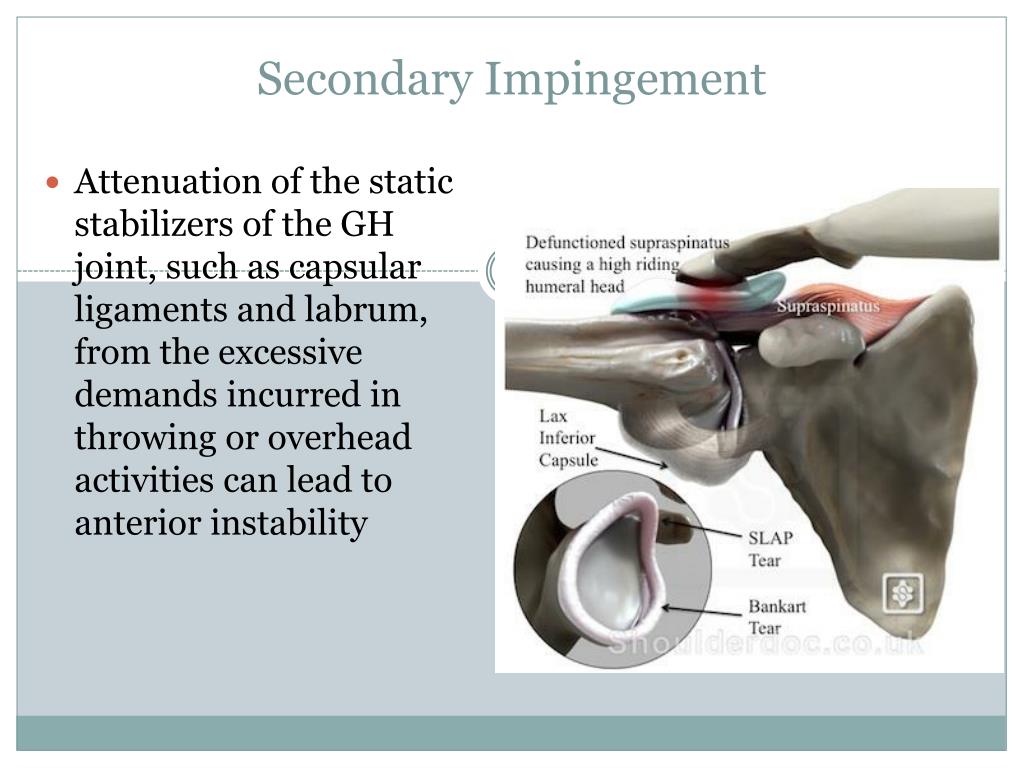 PPT - Rehabilitating Impairments of the Painful Shoulder PowerPoint ...