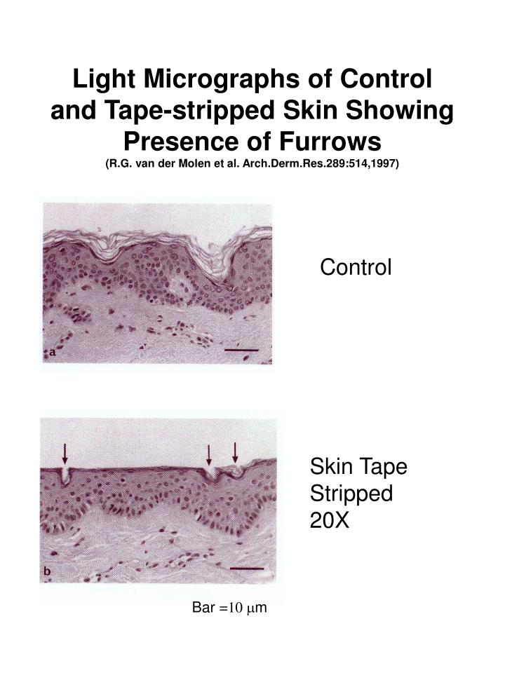 PPT - Skin Tape Stripped 20X PowerPoint Presentation, free download ...