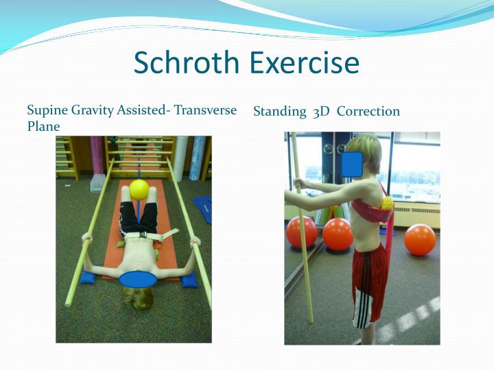 PPT - Schroth Method PowerPoint Presentation - ID:3286349