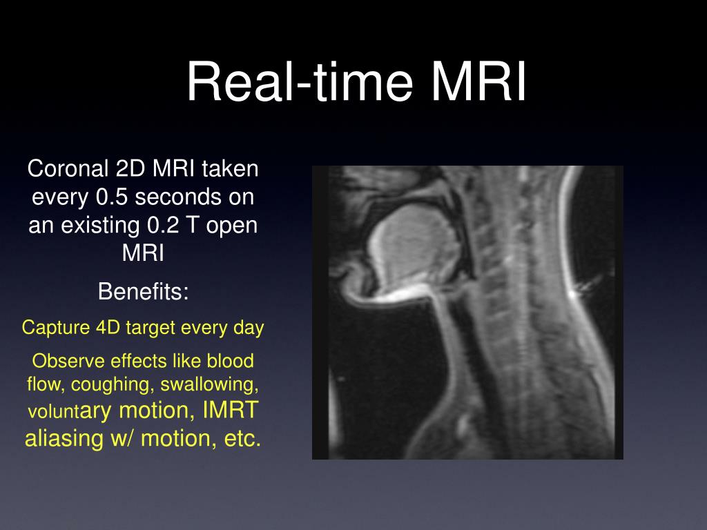 PPT - The Renaissance TM of Radiotherapy? PowerPoint Presentation, free ...