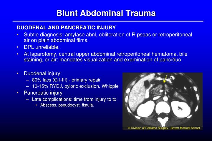 PPT - Abdominal Trauma PowerPoint Presentation - ID:3289814