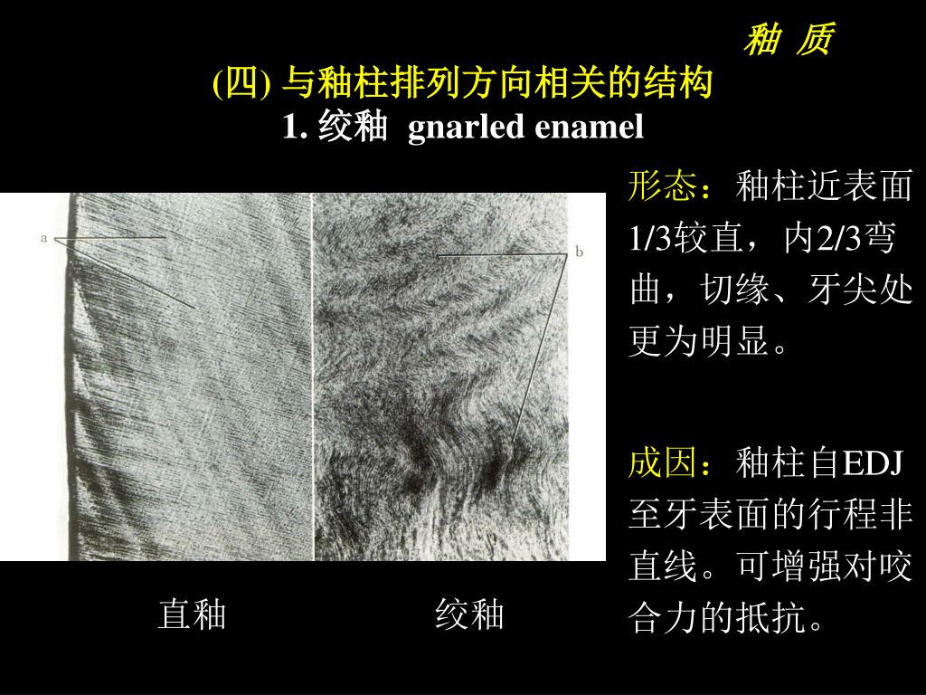 PPT - 口腔组织病理学 Oral Histology and Pathology PowerPoint Presentation - ID ...