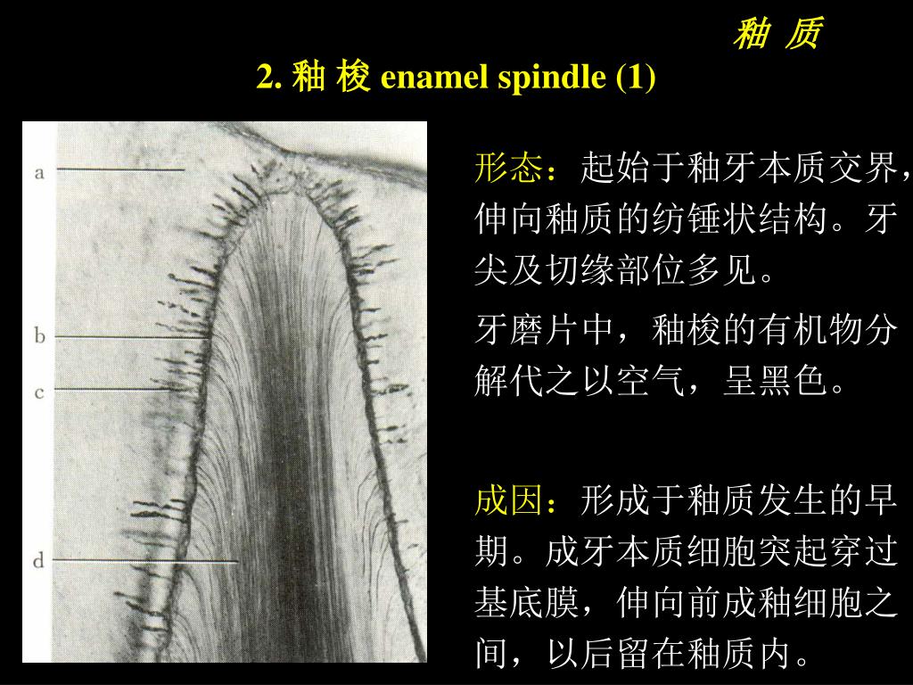 PPT - 口腔组织病理学 Oral Histology and Pathology PowerPoint Presentation - ID ...