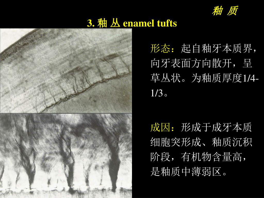 PPT - 口腔组织病理学 Oral Histology and Pathology PowerPoint Presentation - ID ...