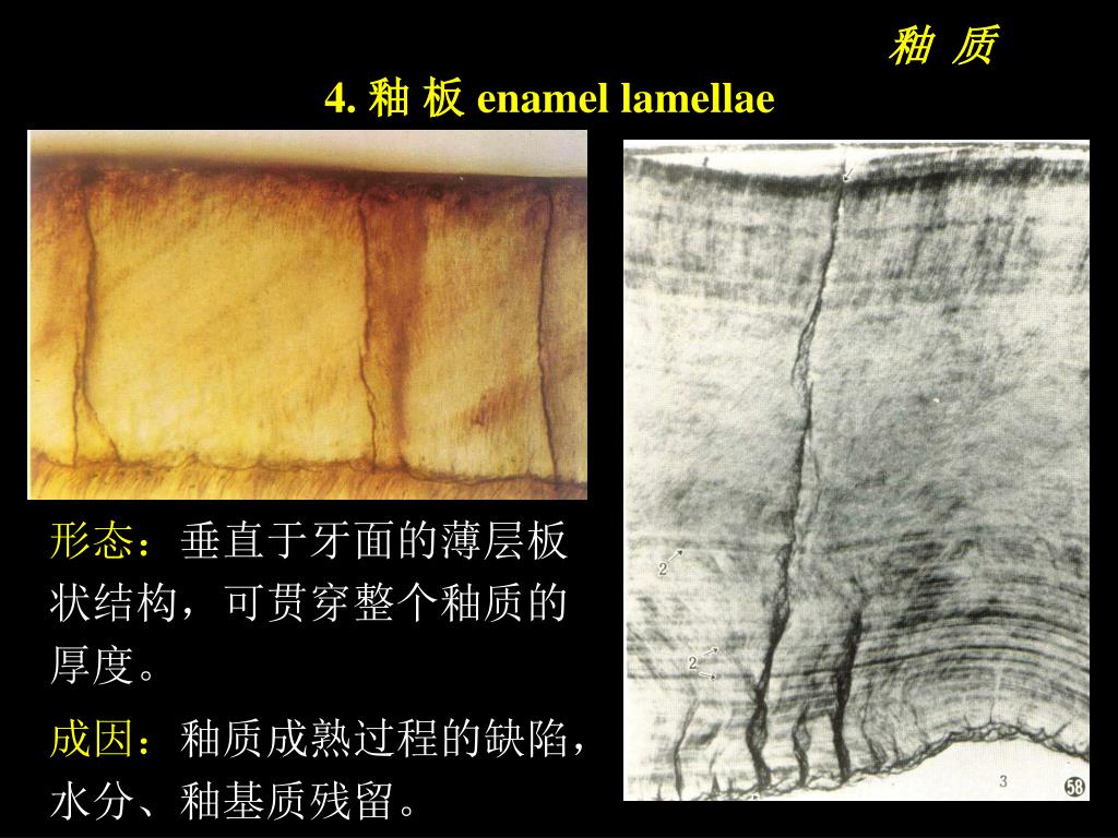 PPT - 口腔组织病理学 Oral Histology and Pathology PowerPoint Presentation - ID ...