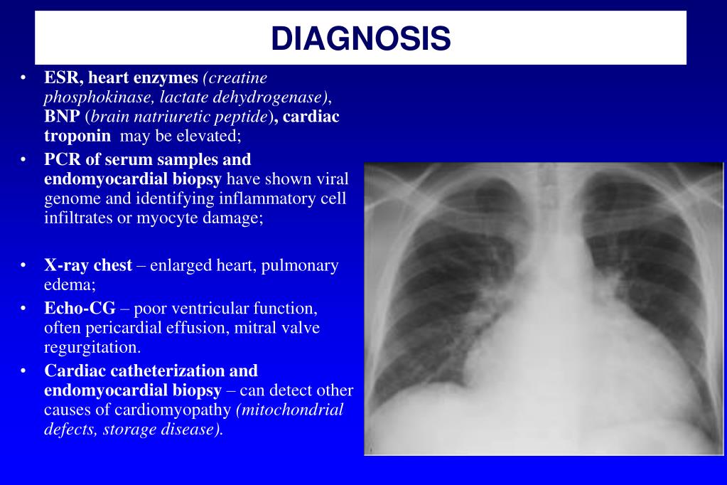 PPT - Nonrheumatic carditis in children. Cardiomyopathy. PowerPoint ...