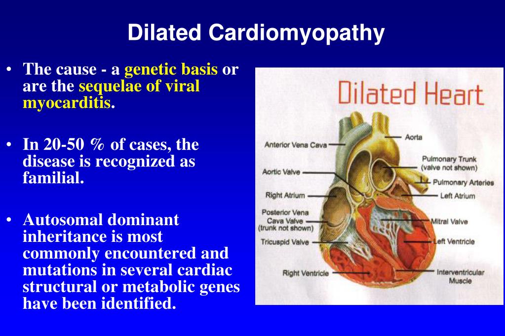 PPT - Nonrheumatic carditis in children. Cardiomyopathy. PowerPoint ...