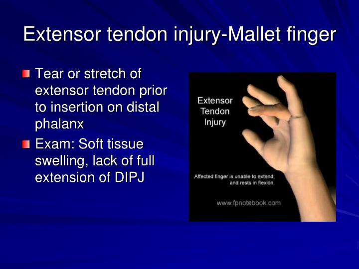 PPT - Examination of the Hand and Wrist PowerPoint Presentation - ID ...