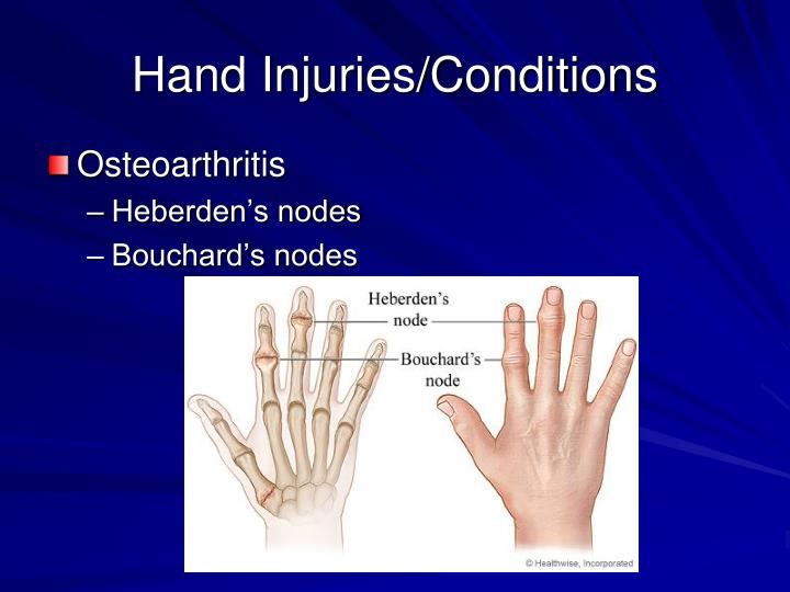 PPT - Examination of the Hand and Wrist PowerPoint Presentation - ID ...