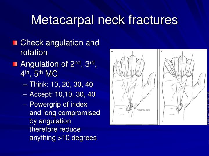 PPT - Examination of the Hand and Wrist PowerPoint Presentation - ID ...