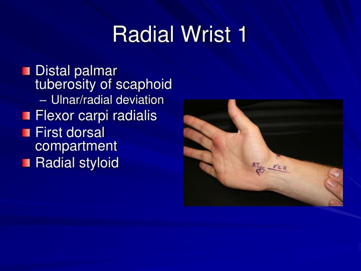 PPT - Examination of the Hand and Wrist PowerPoint Presentation - ID ...