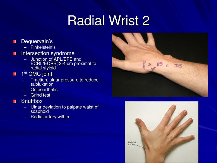 PPT - Examination of the Hand and Wrist PowerPoint Presentation - ID ...