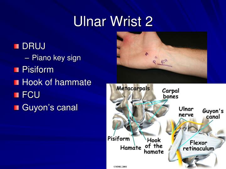 PPT - Examination of the Hand and Wrist PowerPoint Presentation - ID ...