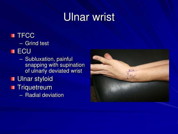 PPT - Examination of the Hand and Wrist PowerPoint Presentation - ID ...