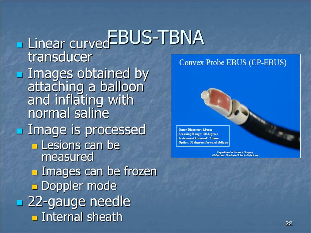 PPT - Endobronchial Ultrasound-Guided Transbronchial Needle Aspiration (EBUS-TBNA) PowerPoint ...