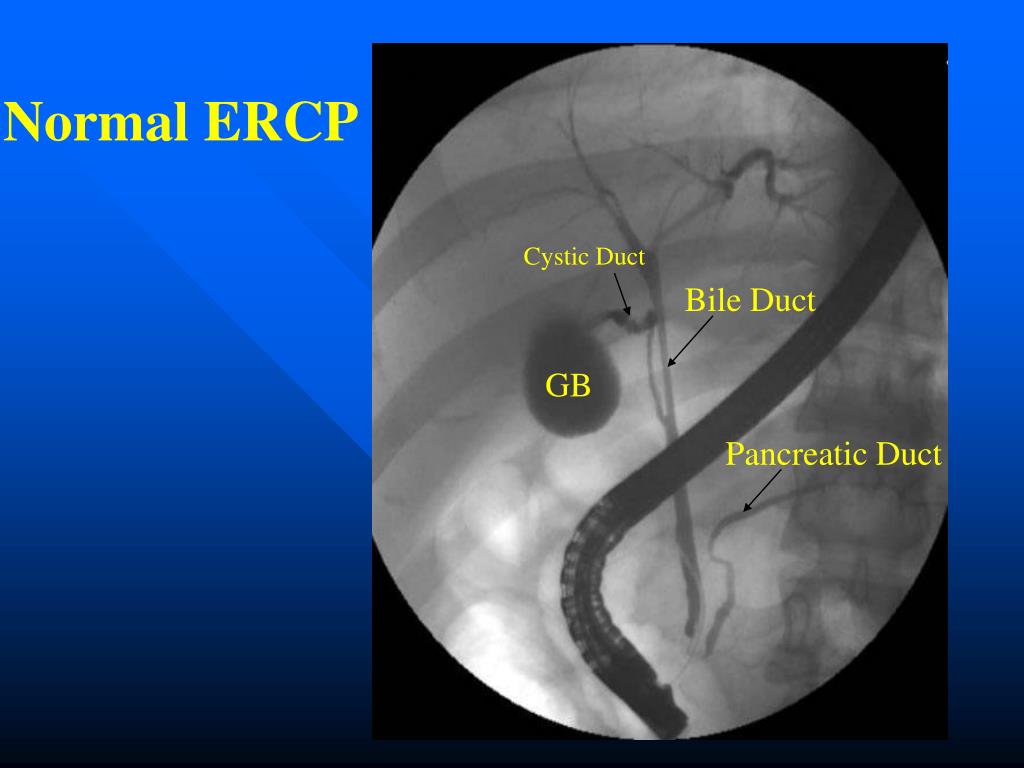 PPT - Pancreatic Cancer: Diagnostic & Maintenance Tools PowerPoint ...