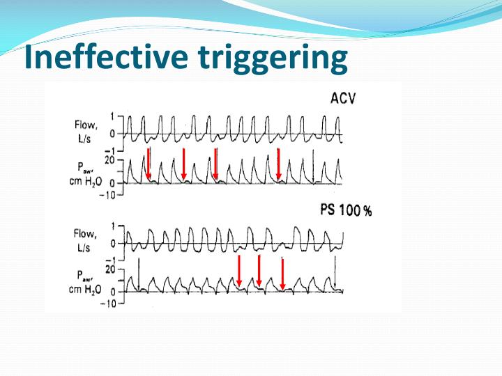 PPT - PATIENT VENTILATOR INTERACTION TRIGGERING AND FLOW PROBLEMS ...
