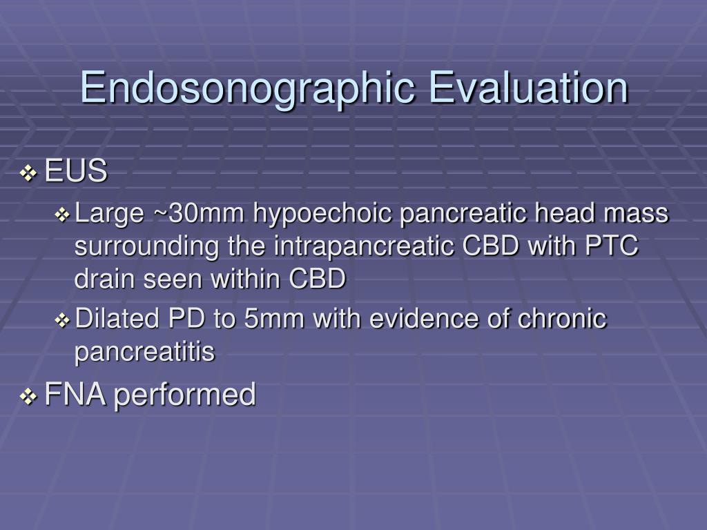 PPT - Endoscopic Ultrasound: Applications in Pre-malignant and ...