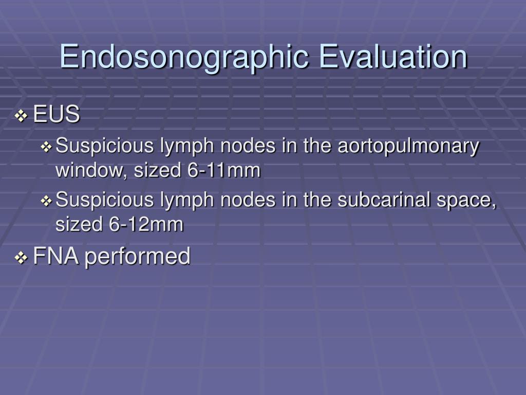 PPT - Endoscopic Ultrasound: Applications in Pre-malignant and ...