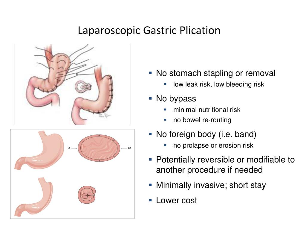 PPT - Phil Schauer, MD Bariatric and Metabolic Institute PowerPoint ...