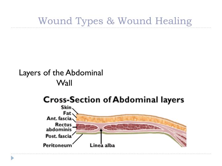 PPT - Wound Healing, Wound Types, Wound Dressings, & Drainage Devices ...
