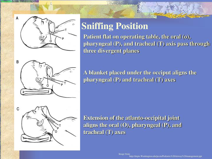 PPT - Basics of Pediatric Airway Anatomy, Physiology and Management ...