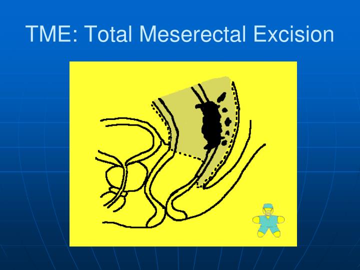 PPT - Cancer Colo-rectal PowerPoint Presentation - ID:3297679
