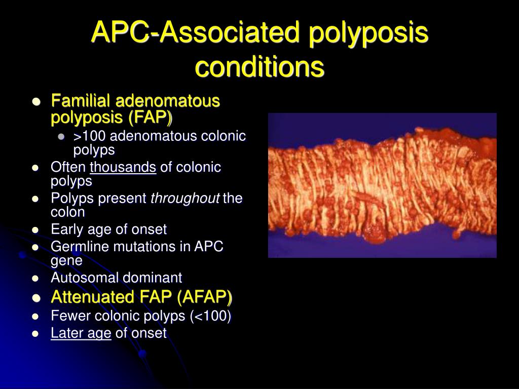 PPT - Novel splice-site mutations as the cause of FAP-related cancer in ...