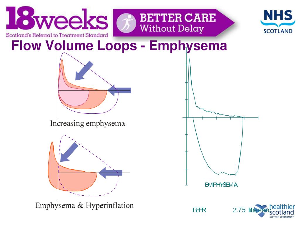 PPT - Respiratory Physiology Diagnostics North East Glasgow PowerPoint ...