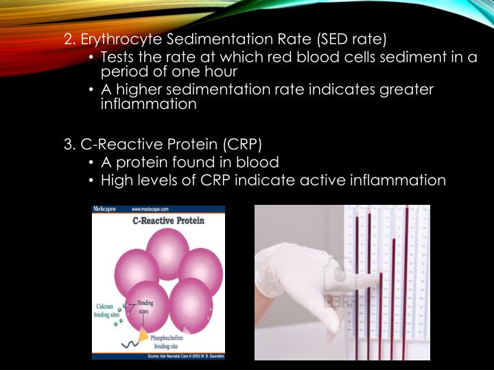 PPT - Rheumatoid Arthritis PowerPoint Presentation - ID:3300588