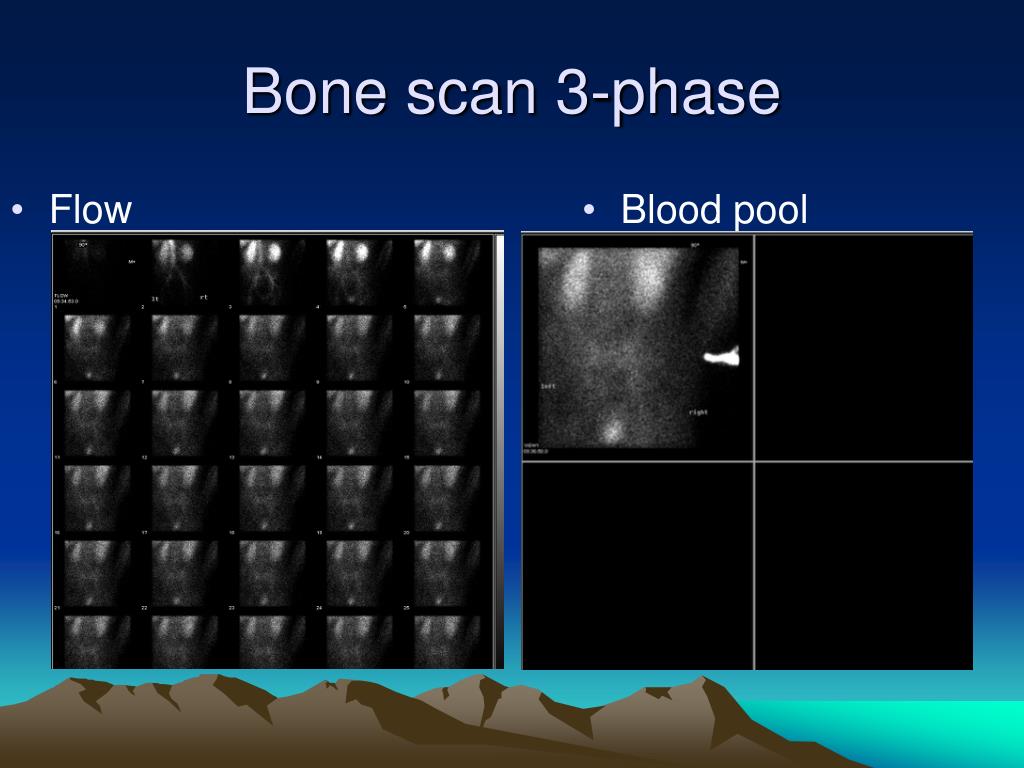 PPT - NUCLEAR MEDICINE & POSITRON EMISSION TOMOGRAPHY PowerPoint ...